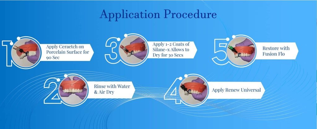 Prevest DenPro Cera Etch Gel | Buy Genuine | Buy Direct