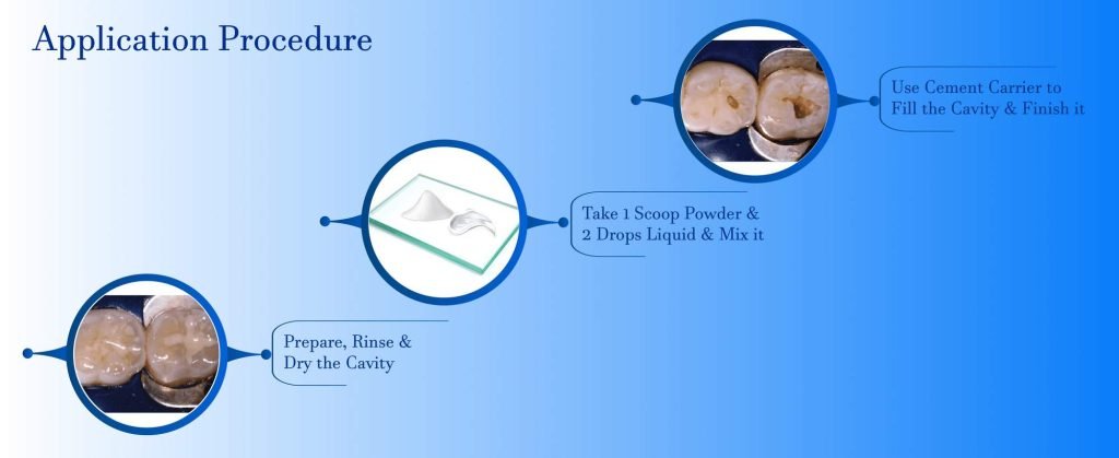 Crysta GIC Mega Combo (Luting + Restorative) - Prevest Direct